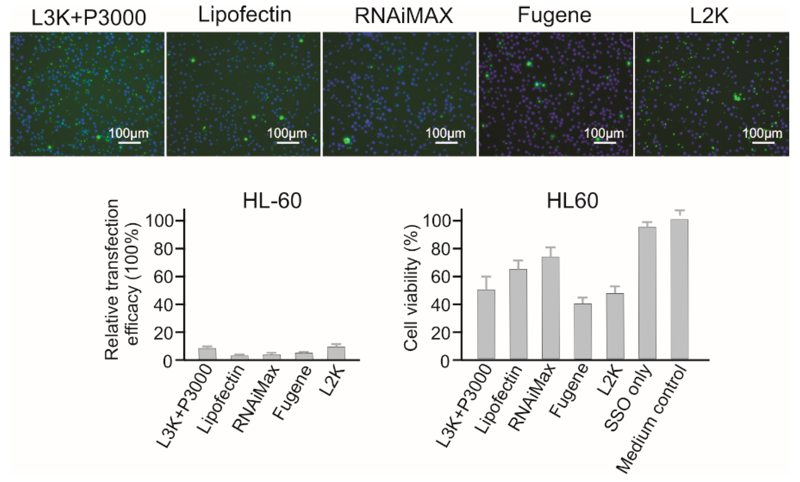 Systematic Screening of Commonly Used Commercial Transfection Reagents ...