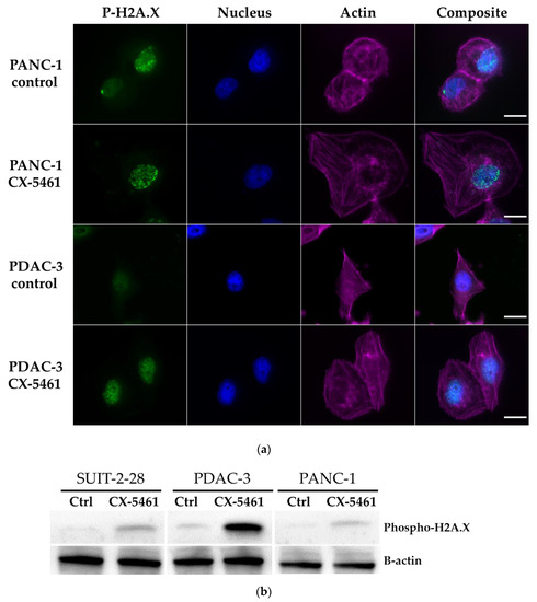 CX-5461 Inhibits Pancreatic Ductal Adenocarcinoma Cell Growth ...