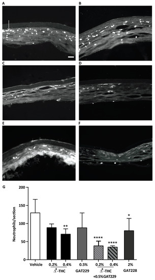 Allosteric Cannabinoid Receptor 1 (CB1) Ligands Reduce Ocular Pain and ...