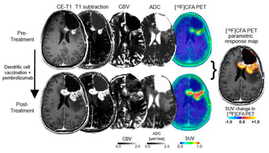 Current Landscape and Emerging Fields of PET Imaging in Patients with ...