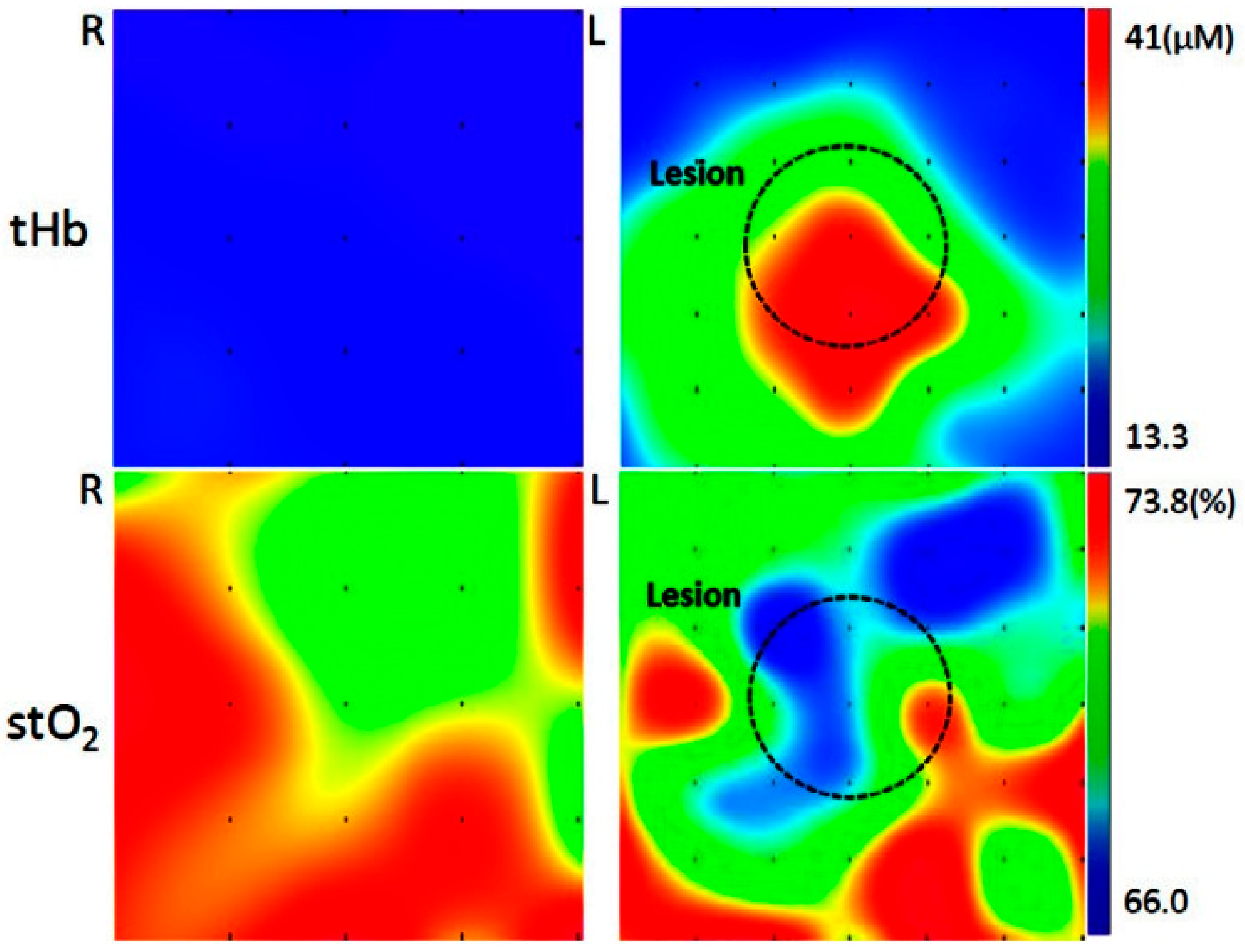 Molecules | Free Full-Text | Near-Infrared Spectroscopy in Bio-Applications