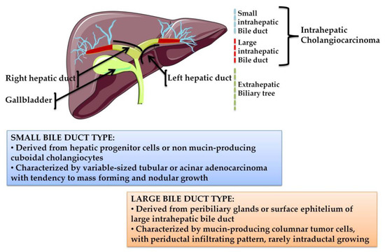 IDH1 Targeting as a New Potential Option for Intrahepatic Cholangiocarcinoma Treatment—Current ...