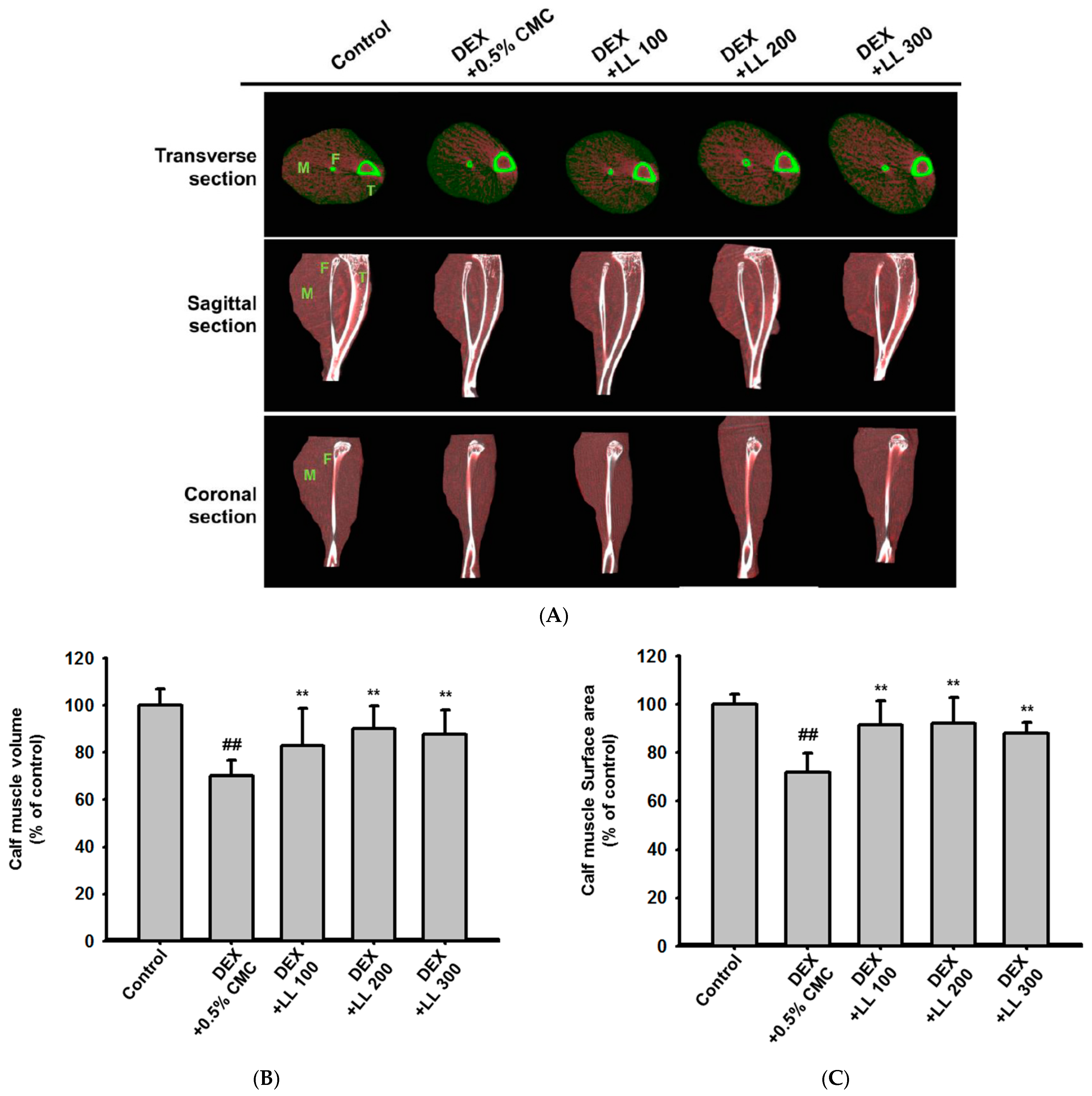 Gastrocnemius Muscle Mouse