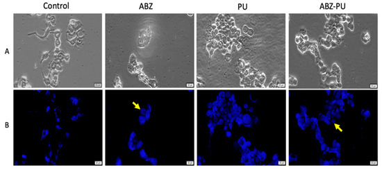 Molecules | Free Full-Text | Solid Polymeric Nanoparticles of ...