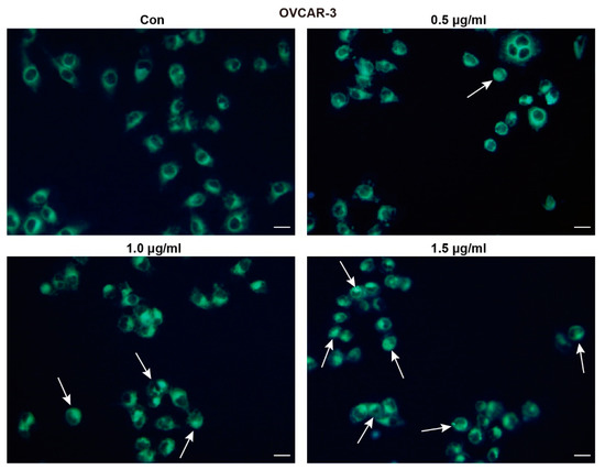Molecules | Free Full-Text | Saponins Extracted from Tea (Camellia ...