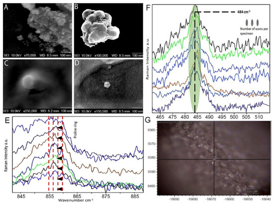 Effect of Propolis Nanoparticles against Enterococcus faecalis Biofilm ...