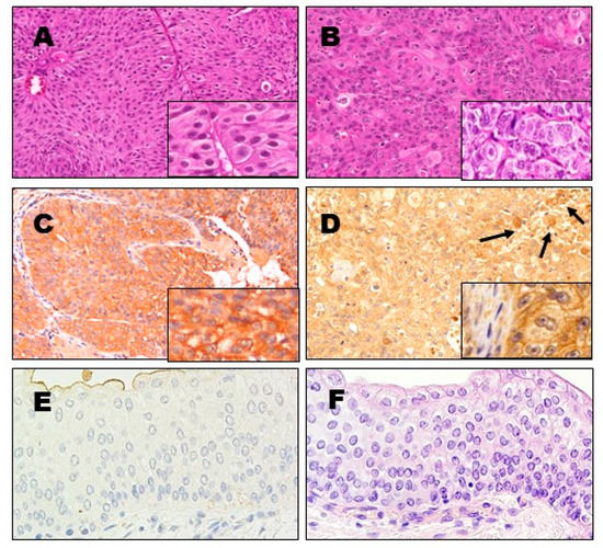 Expression of Luteinizing Hormone-Releasing Hormone (LHRH) and Type-I ...