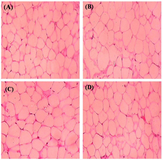 β-Sitosterol Circumvents Obesity Induced Inflammation and Insulin ...