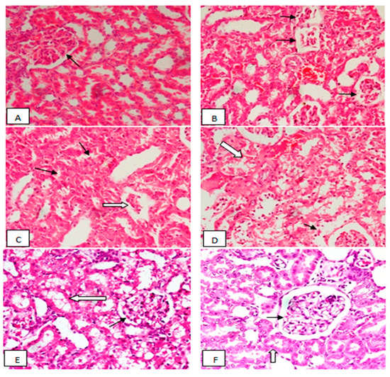 Molecules | Special Issue : Bioanalysis and Biological Matrix Sampling