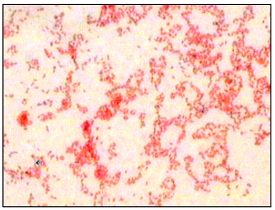 Production of Biodegradable Polymer from Agro-Wastes in Alcaligenes sp ...