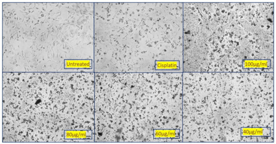 Biogenic Synthesis of NiO Nanoparticles Using Areca catechu Leaf ...