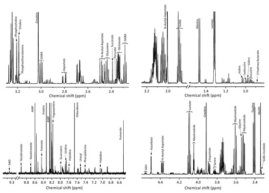 The Effect of Blood Contained in the Samples on the Metabolomic Profile ...