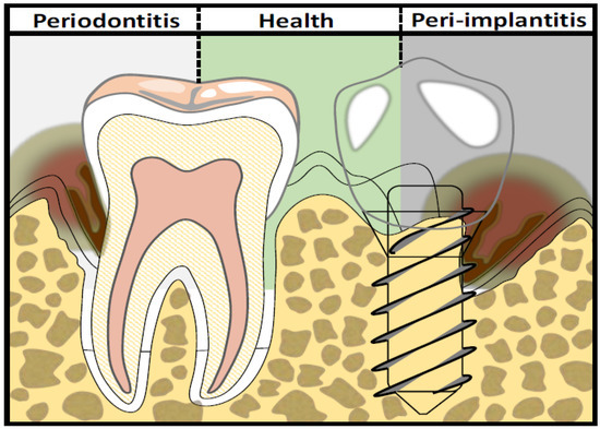 Local Oral Delivery Agents with Anti-Biofilm Properties for the ...