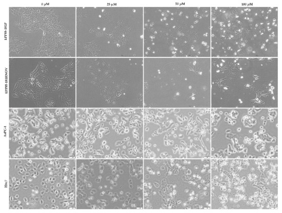 Effect of Resveratrol Treatment on Human Pancreatic Cancer Cells ...