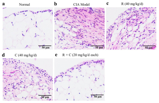 Rosmanol and Carnosol Synergistically Alleviate Rheumatoid Arthritis ...