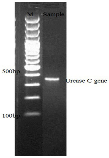Expression, Purification, and Comparative Inhibition of Helicobacter ...