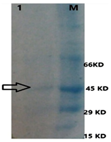 Expression, Purification, and Comparative Inhibition of Helicobacter ...