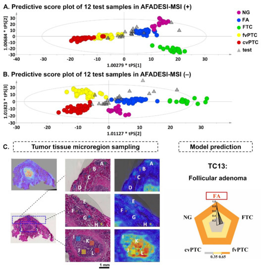 Molecular Pathological Diagnosis of Thyroid Tumors Using Spatially ...