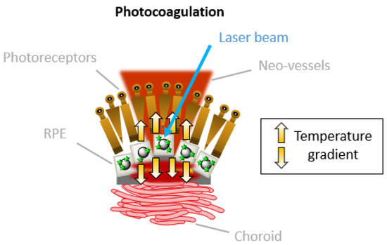 Recent Advances in Age-Related Macular Degeneration Therapies