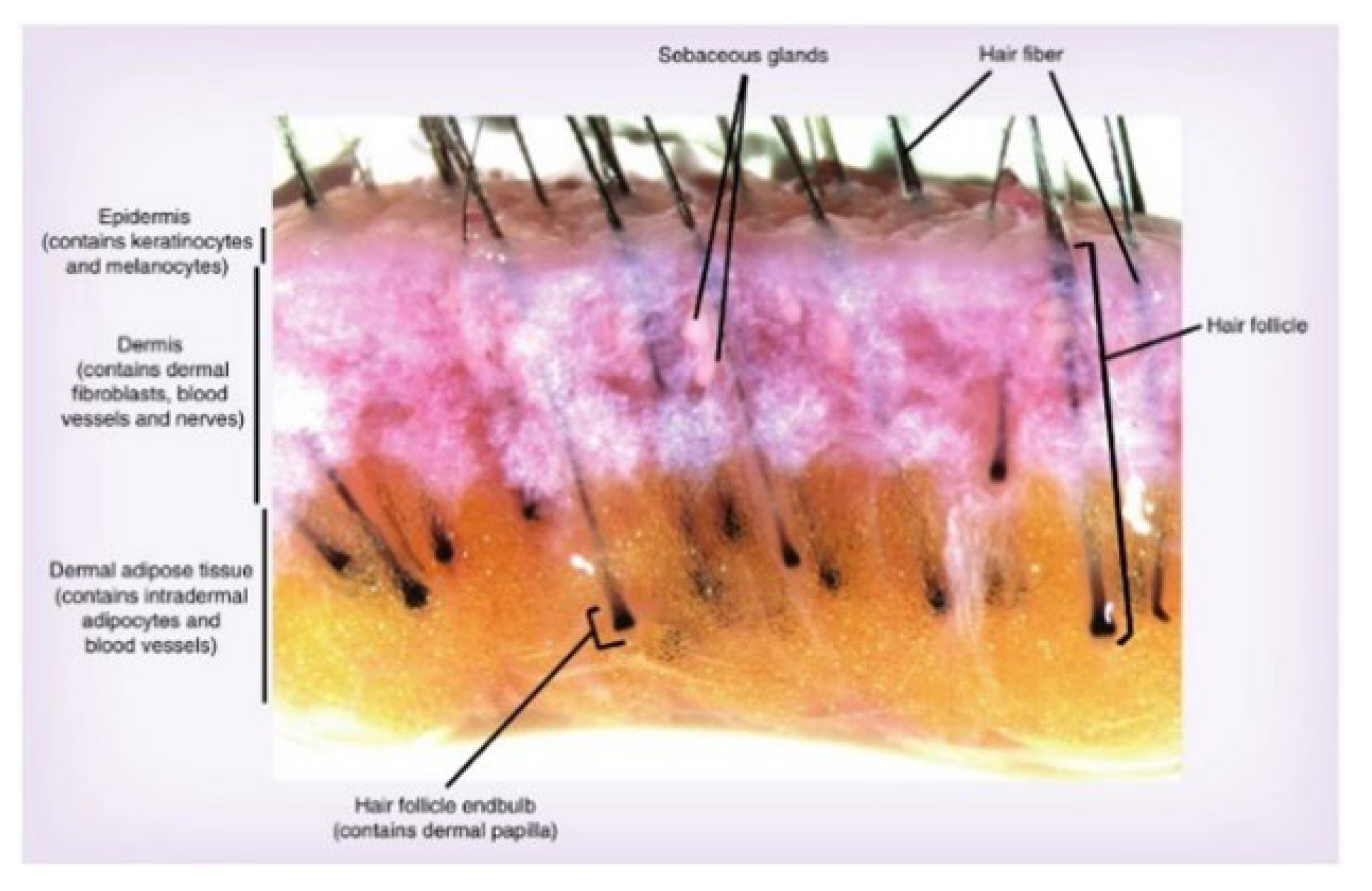Staphylococcus epidermidis Cicaria, a Novel Strain Derived from the ...