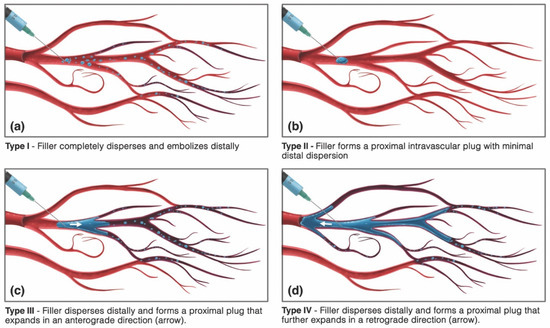 Bridging a Century-Old Problem: The Pathophysiology and Molecular ...