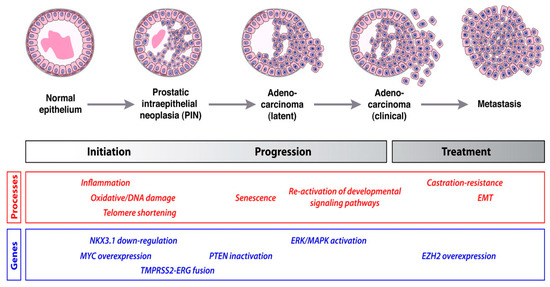 Molecules | Free Full-Text | Prostate Cancer Review: Genetics ...