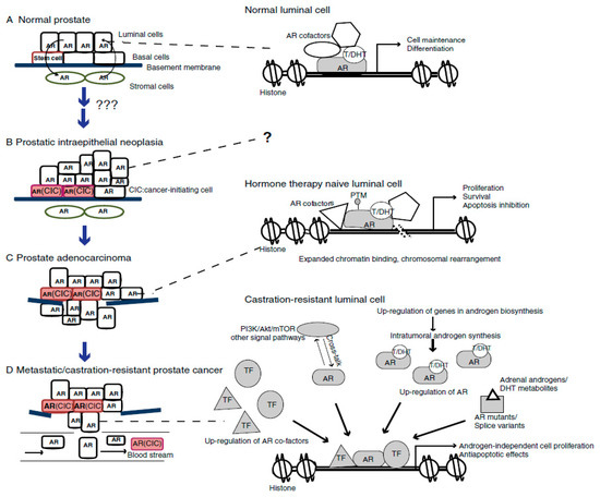 Prostate Cancer Review: Genetics, Diagnosis, Treatment Options, and ...