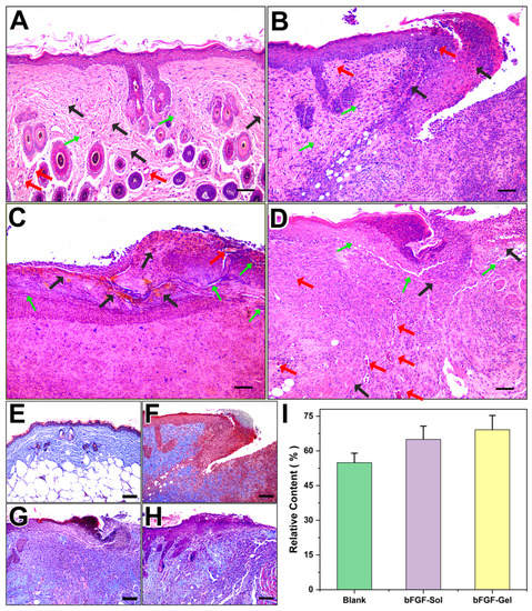 Hydrogel Dressing Containing Basic Fibroblast Growth Factor ...