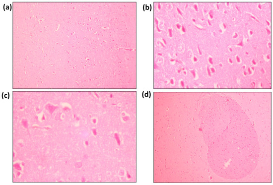 Rutin Improves Anxiety and Reserpine-Induced Depression in Rats