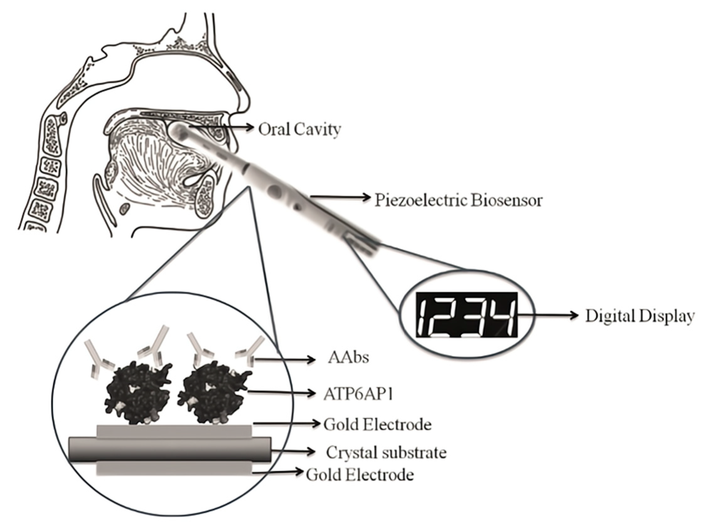 Recent Progress in Biosensors for Detection of Tumor Biomarkers