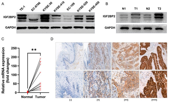 Identification of an IGF2BP2-Targeted Peptide for Near-Infrared Imaging ...