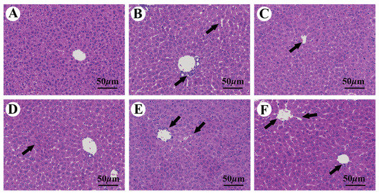 Ethyl Acetate Extract from Artemisia argyi Prevents Liver Damage in ...