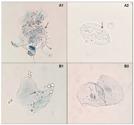 Antifungal Effect and Inhibition of the Virulence Mechanism of D ...