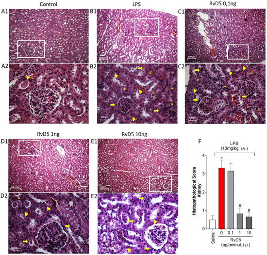 Resolvin D5 (RvD5) Reduces Renal Damage Caused by LPS Endotoxemia in ...