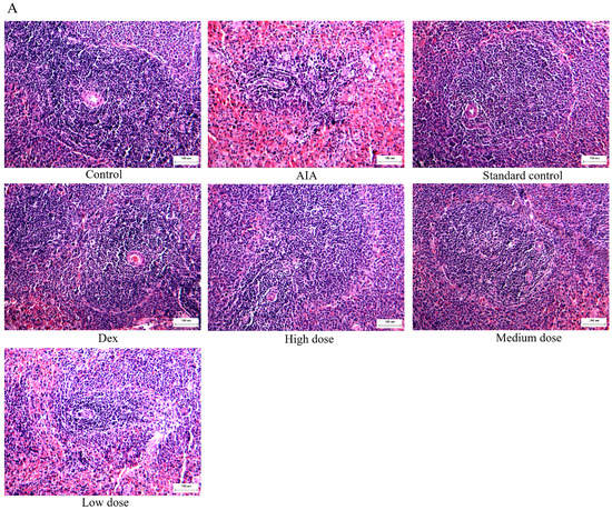 The Effective Treatment of Purpurin on Inflammation and Adjuvant ...