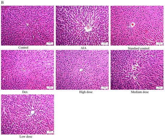 The Effective Treatment of Purpurin on Inflammation and Adjuvant ...