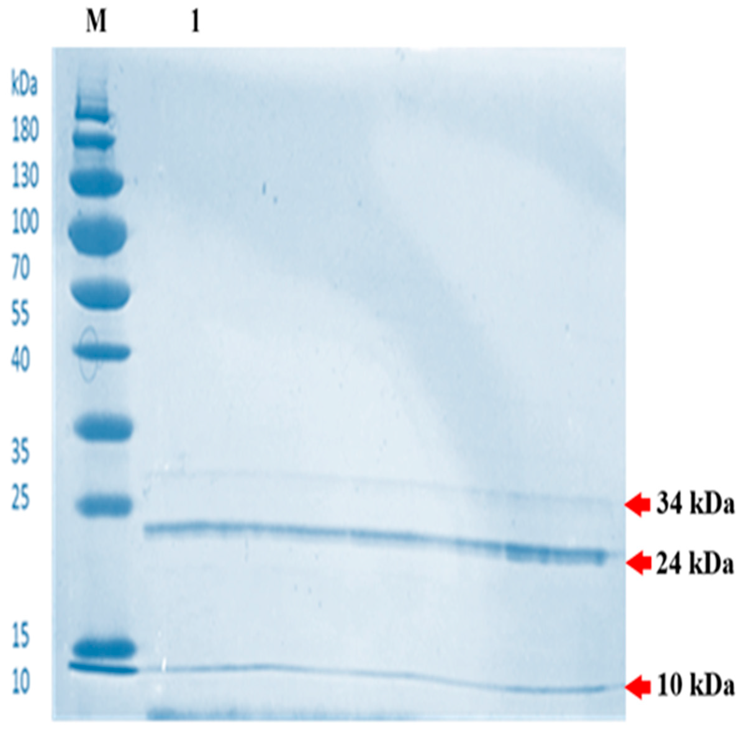 Purification, Characterization and Bactericidal Action of Lysozyme ...