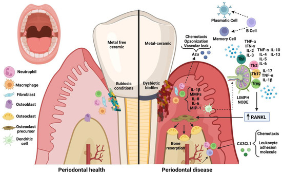 Potential Impact of Prosthetic Biomaterials on the Periodontium: A ...