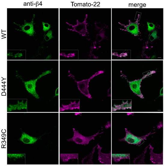 Rare Missense Variants of the Human β4 Subunit Alter Nicotinic α3β4 ...