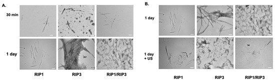 Amyloid-like RIP1/RIP3 RHIM Fragments’ Characterization and Application ...