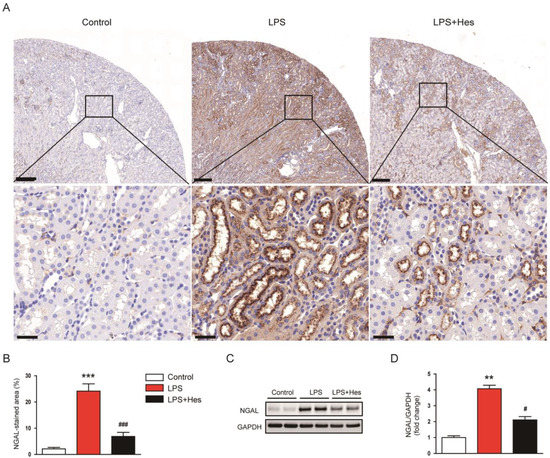 Antioxidant, Antiapoptotic, and Anti-Inflammatory Effects of Hesperetin ...