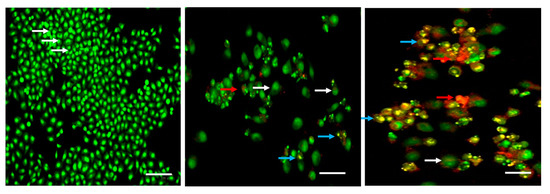 Therapeutic Potential of Albumin Nanoparticles Encapsulated Visnagin in ...