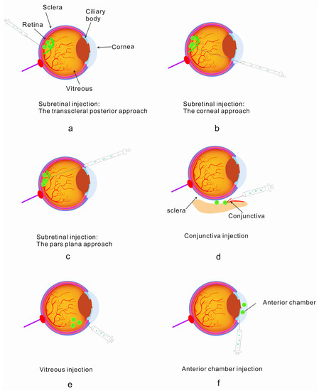 Nanotechnology Lighting the Way for Gene Therapy in Ophthalmopathy ...