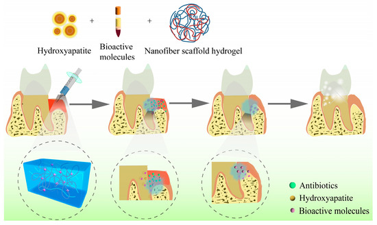 Hydrogels for Oral Tissue Engineering: Challenges and Opportunities