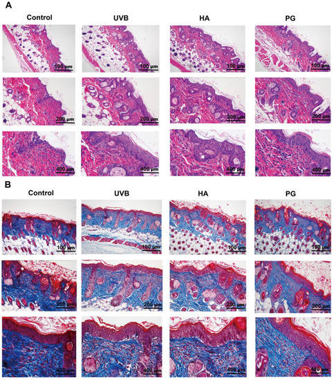 The Mechanism of Peach Gum Polysaccharide Preventing UVB-Induced Skin ...