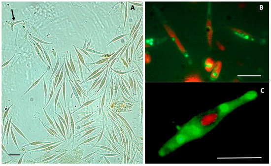 Xanthophyll-Rich Extract of Phaeodactylum tricornutum Bohlin as New ...