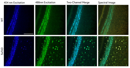Quantitation of Tissue Amyloid via Fluorescence Spectroscopy Using Controlled Concentrations of ...