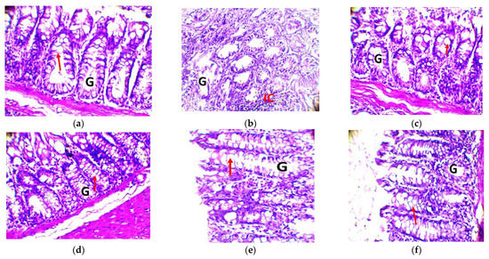 Antioxidant, Anti-Inflammatory, and Anti-Cancer Properties of Amygdalin ...