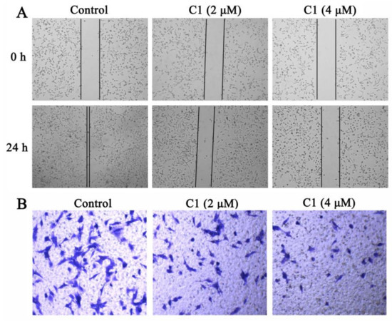 Molecules | Free Full-Text | Anticancer Activity and Mode of Action of Cu(II), Zn(II), and Mn(II ...