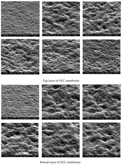 Molecules | Free Full-Text | Chitosan and Its Carboxymethyl-Based Membranes Produced by ...